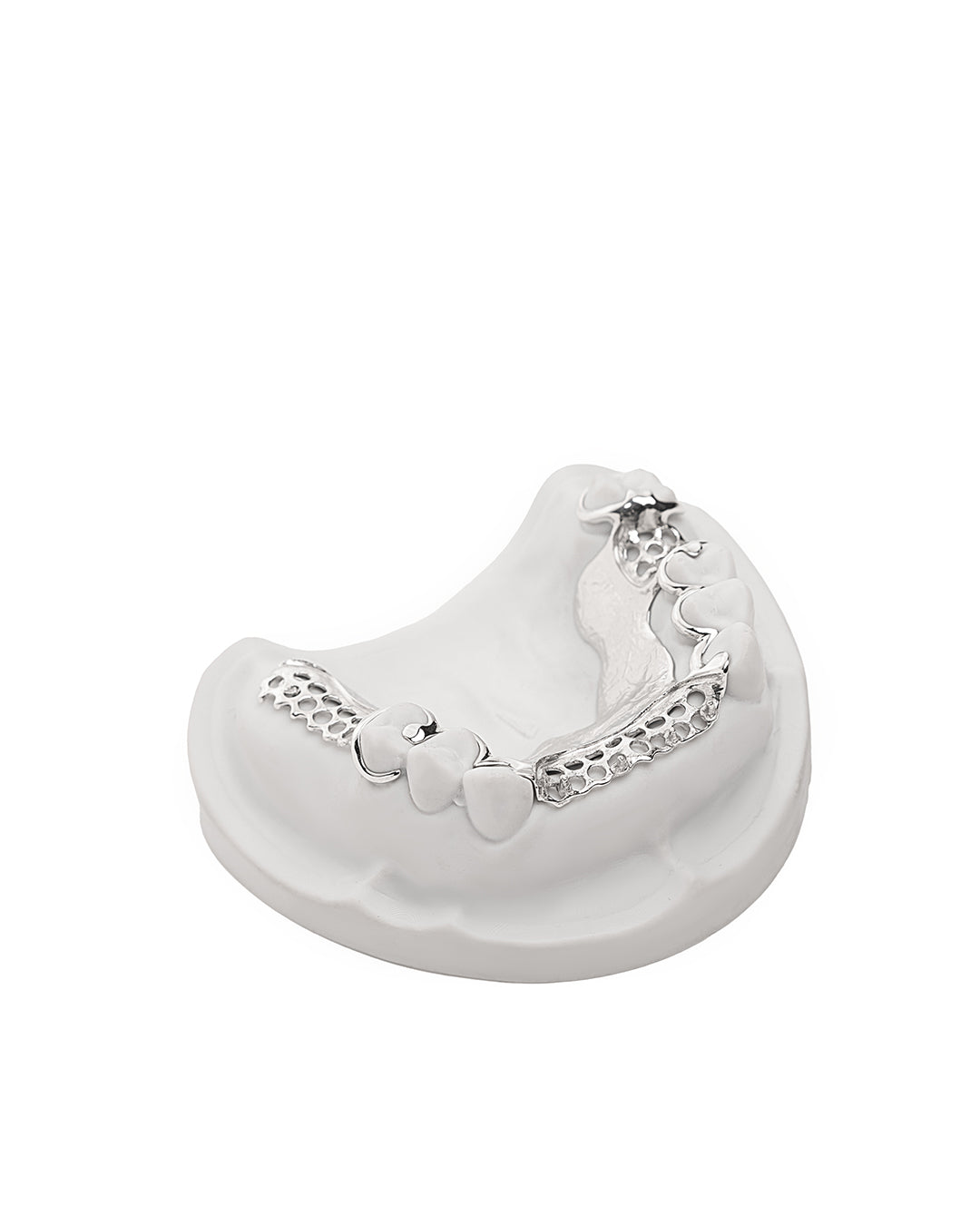 Partial Framework – Lightning Dental Lab